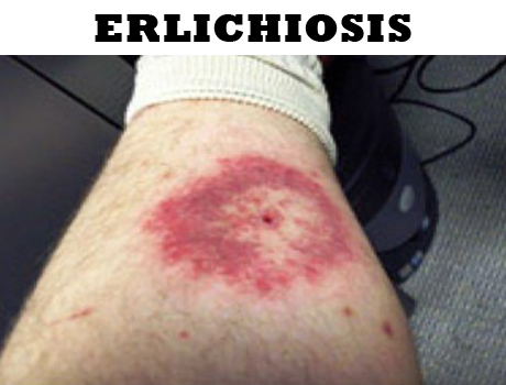 Deer and Tick Guard - Tick Control and Plant Protection